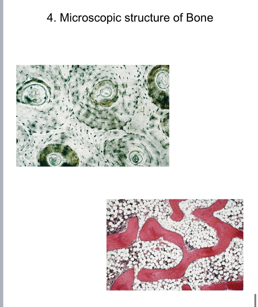 Solved 4. Microscopic structure of Bone | Chegg.com