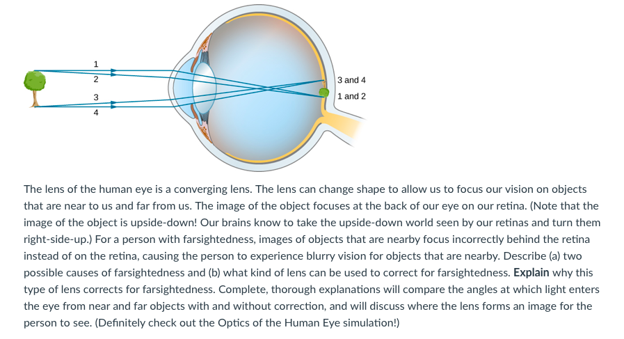 Solved Describe (a) two possible causes of farsightedness | Chegg.com