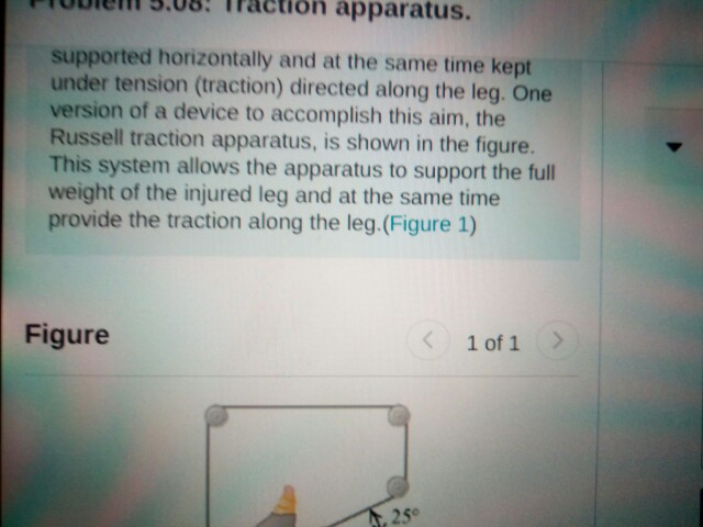 Solved Chapter 5 Problem 5.08: Traction apparatus. In order | Chegg.com
