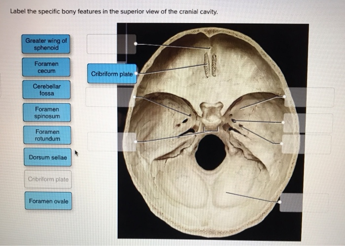 Solved Label The Specific Bony Features In The Superior View Chegg
