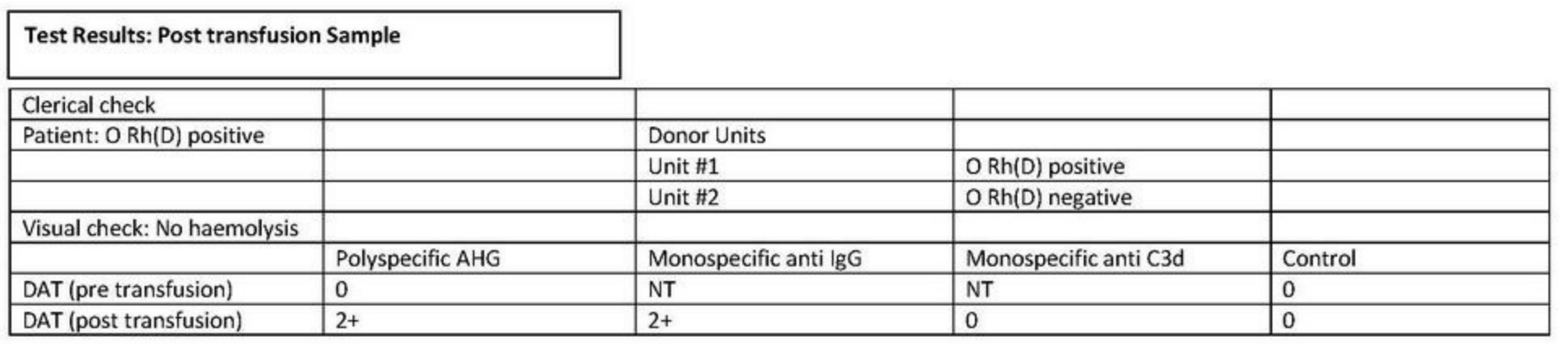 (blood banking) According to the tables of blood | Chegg.com
