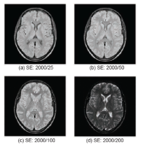 Solved Assume an MRI spin-echo (SE) sequence with B0 = 0.5 T | Chegg.com