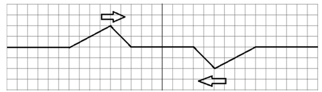 Solved Two pulses on a string are moving towards each other | Chegg.com