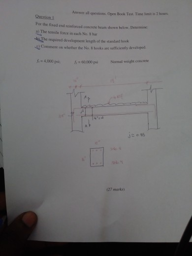 Solved (i) The total claim amount X made in one year on a | Chegg.com