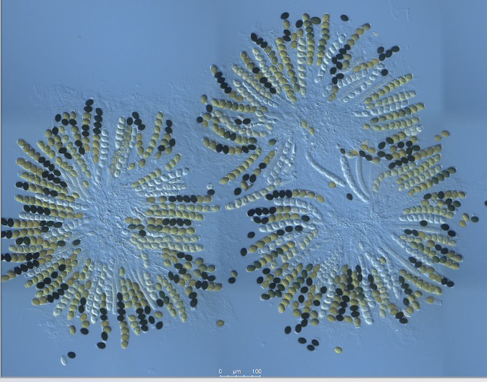 Solved 2. a. which pattern of 4 black and 4 tan spores | Chegg.com