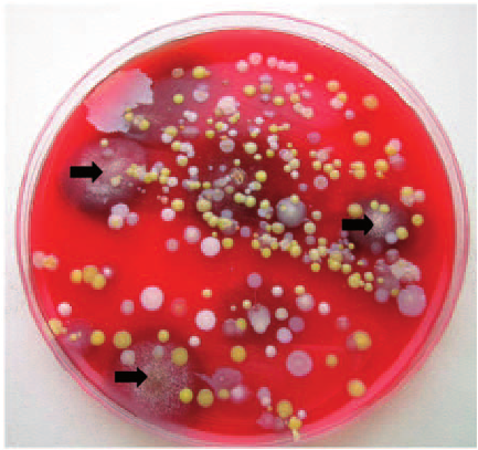 Solved Describe how to heat-fix a slide for gram stain. | Chegg.com