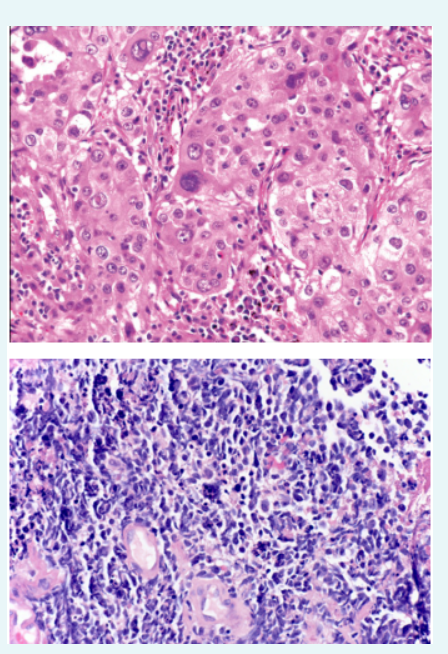 Solved Top image: a section of lung stroma that is | Chegg.com