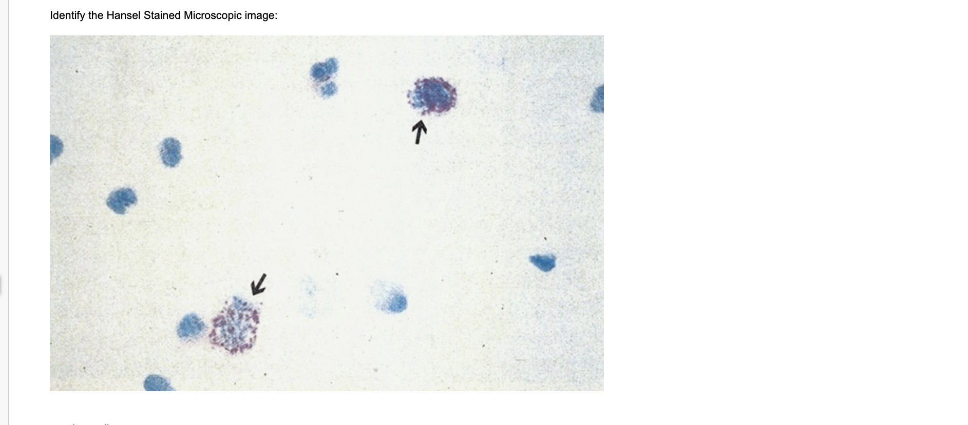 Solved Identify the predominant microscopic image | Chegg.com