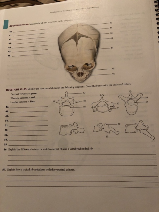 Solved Classifying Bones According to Location Bones can be | Chegg.com