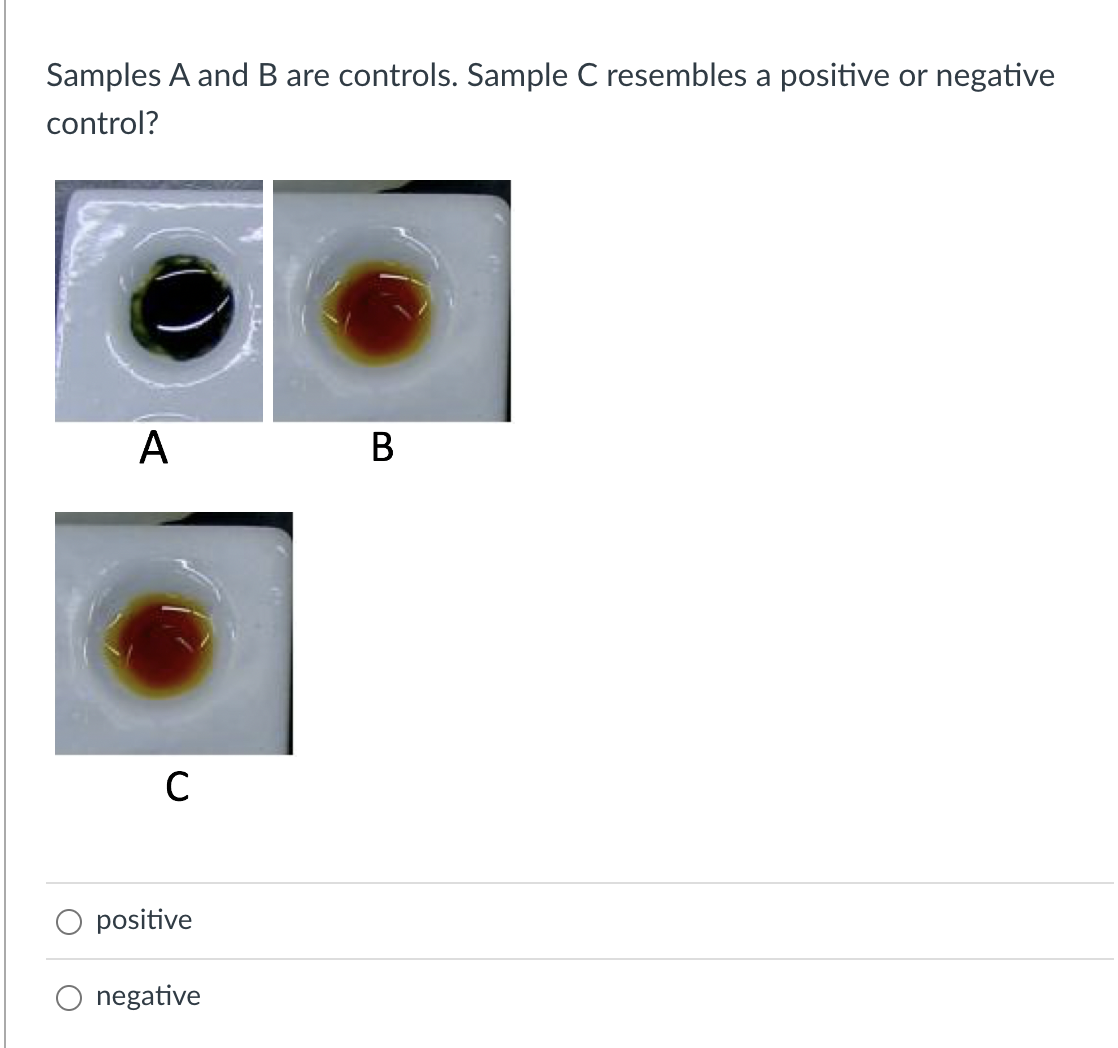 Solved Samples A and B are controls. Sample C resembles a | Chegg.com
