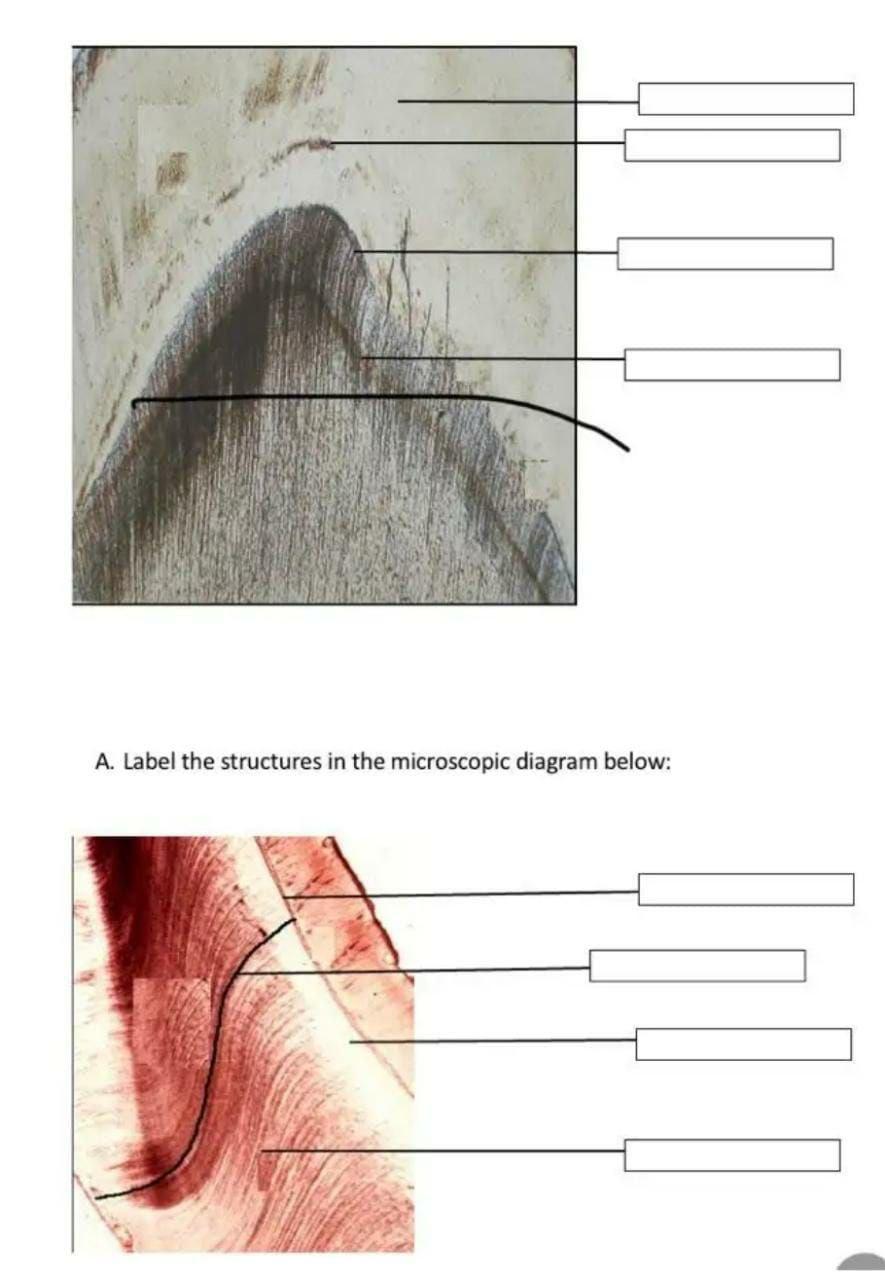 Solved A. Label the structures in the microscopic diagram | Chegg.com