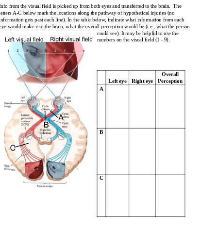 Solved nfo from the visual field is picked up from both eyes | Chegg.com