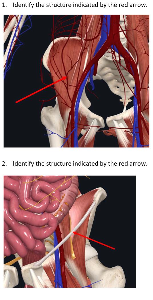 Solved 1. Identify the structure indicated by the red arrow. | Chegg.com