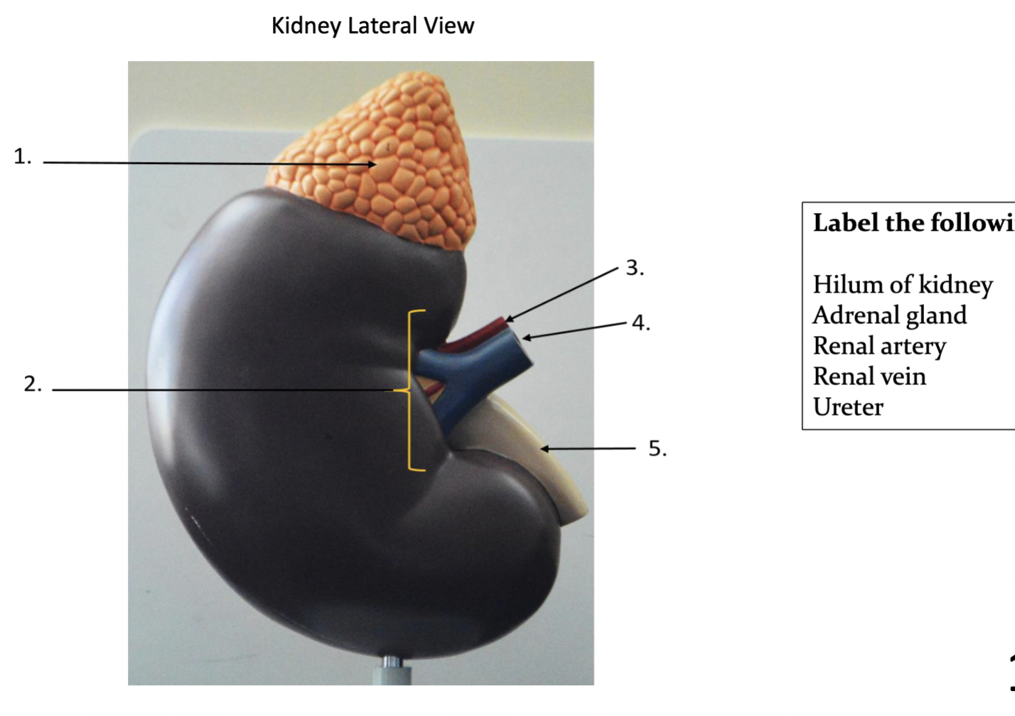 Solved Kidney Lateral View Vidnn, Crontal Dlonn I atoml | Chegg.com