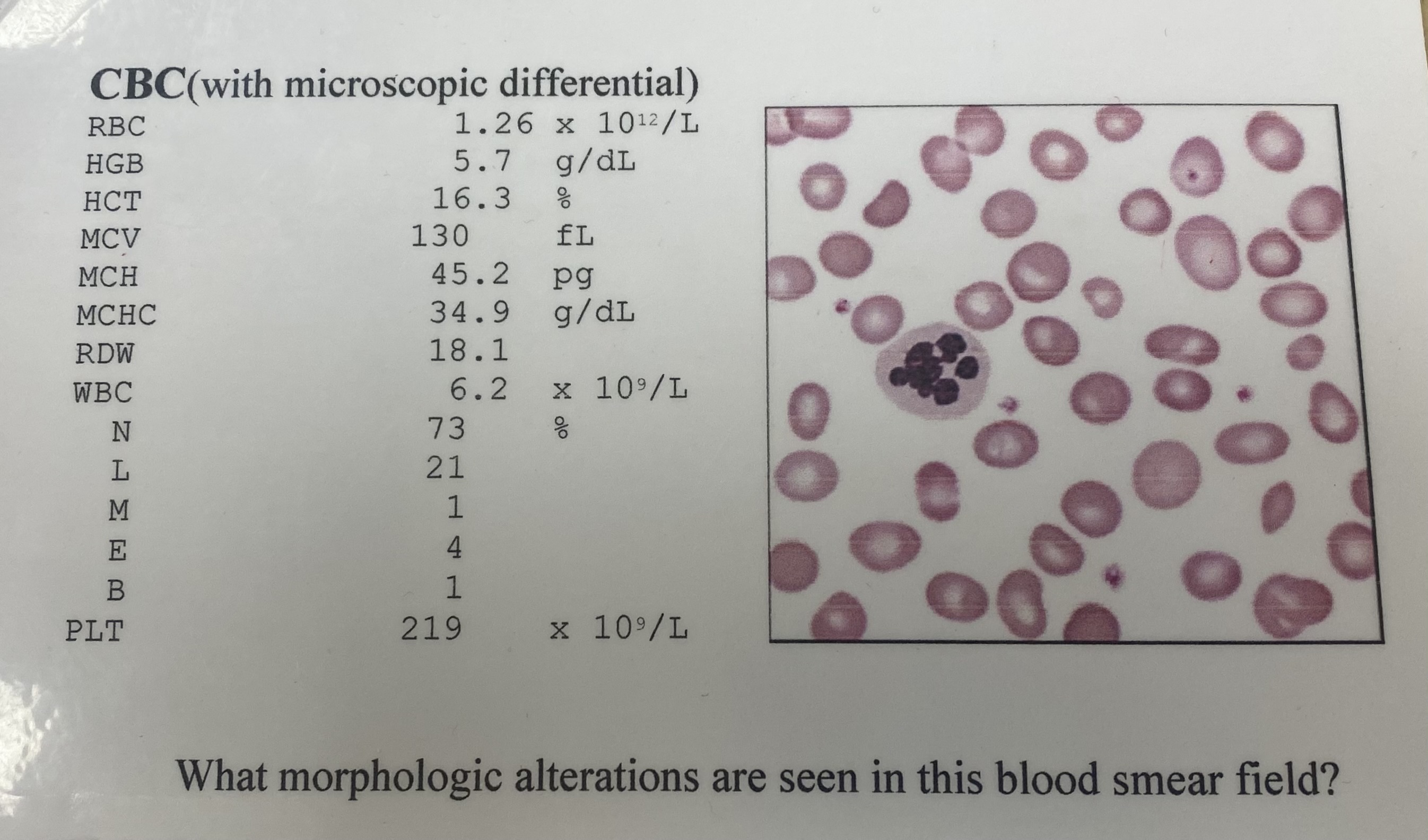 Solved What is the diagnosis of this patient (short | Chegg.com