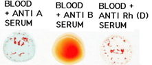 Solved Identify the following blood type:ResponsesB+B-A-A+ | Chegg.com