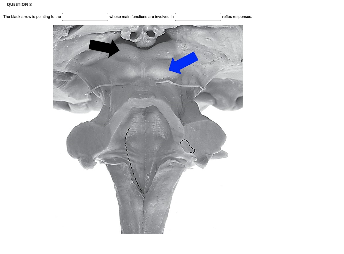 Solved The black arrow is pointing to theNhose main | Chegg.com