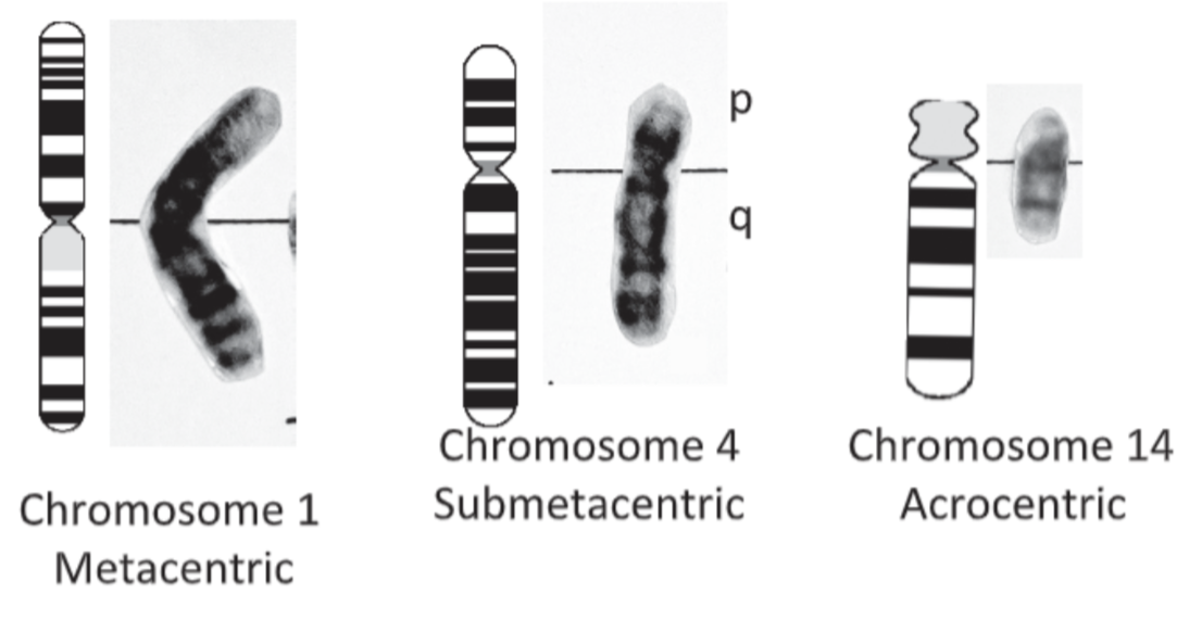 Solved р q TID TIL ID Chromosome 4 Submetacentric Chromosome | Chegg.com