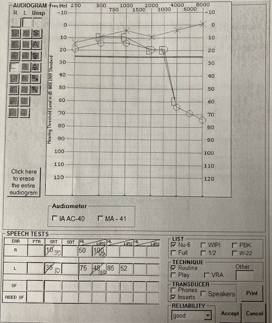 Solved Can I get some help explaining the type | Chegg.com