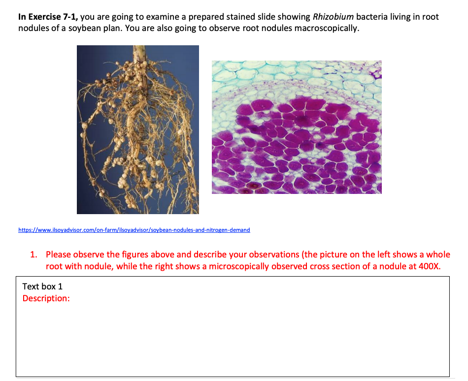 Rhizobium Microscope