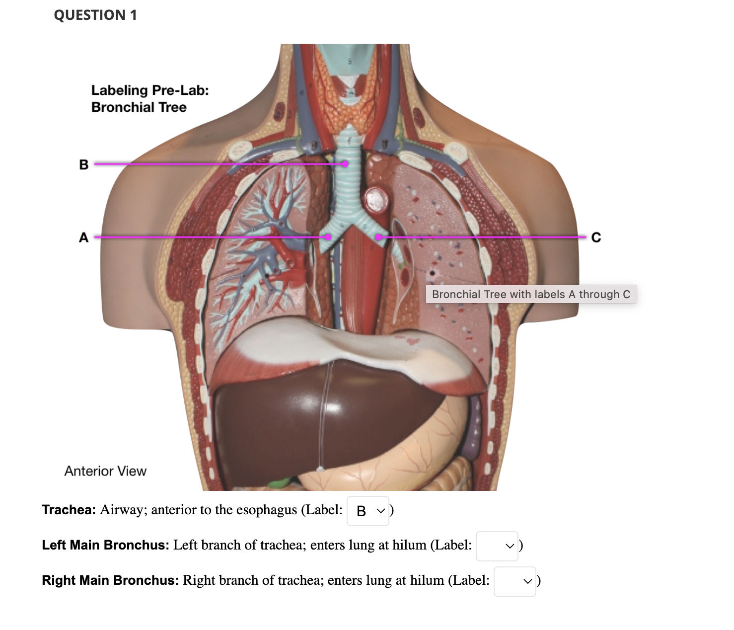 Solved QUESTION 1 Trachea: Airway; anterior to the esophagus | Chegg.com