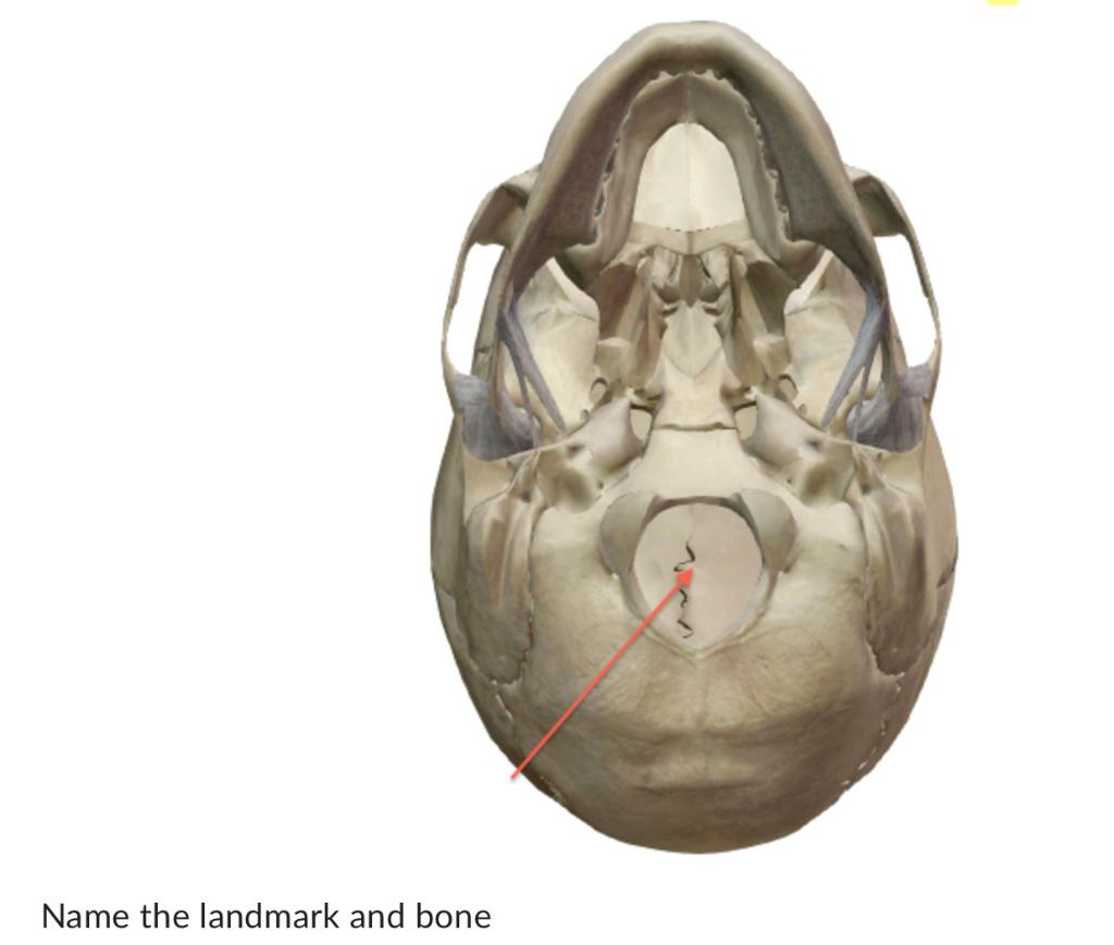 Solved Name the landmark and bone | Chegg.com