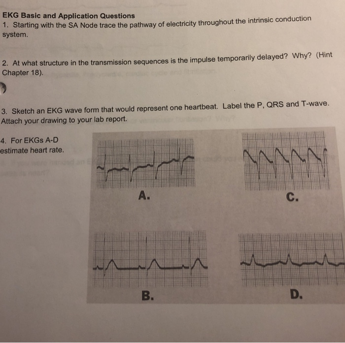 Solved EKG Basic and Application Questions 1. Startin | Chegg.com