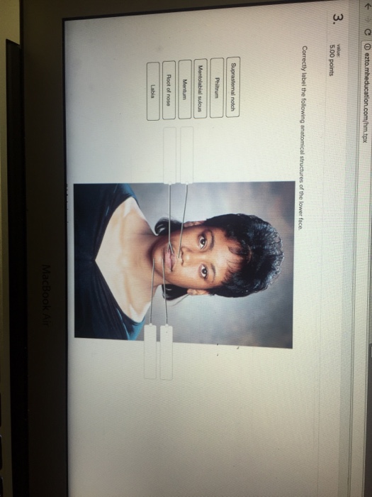 Solved Correctly label the following anatomical structures | Chegg.com