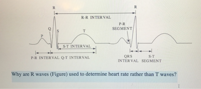 Solved Why are R waves (Figure) used to determine heart rate | Chegg.com