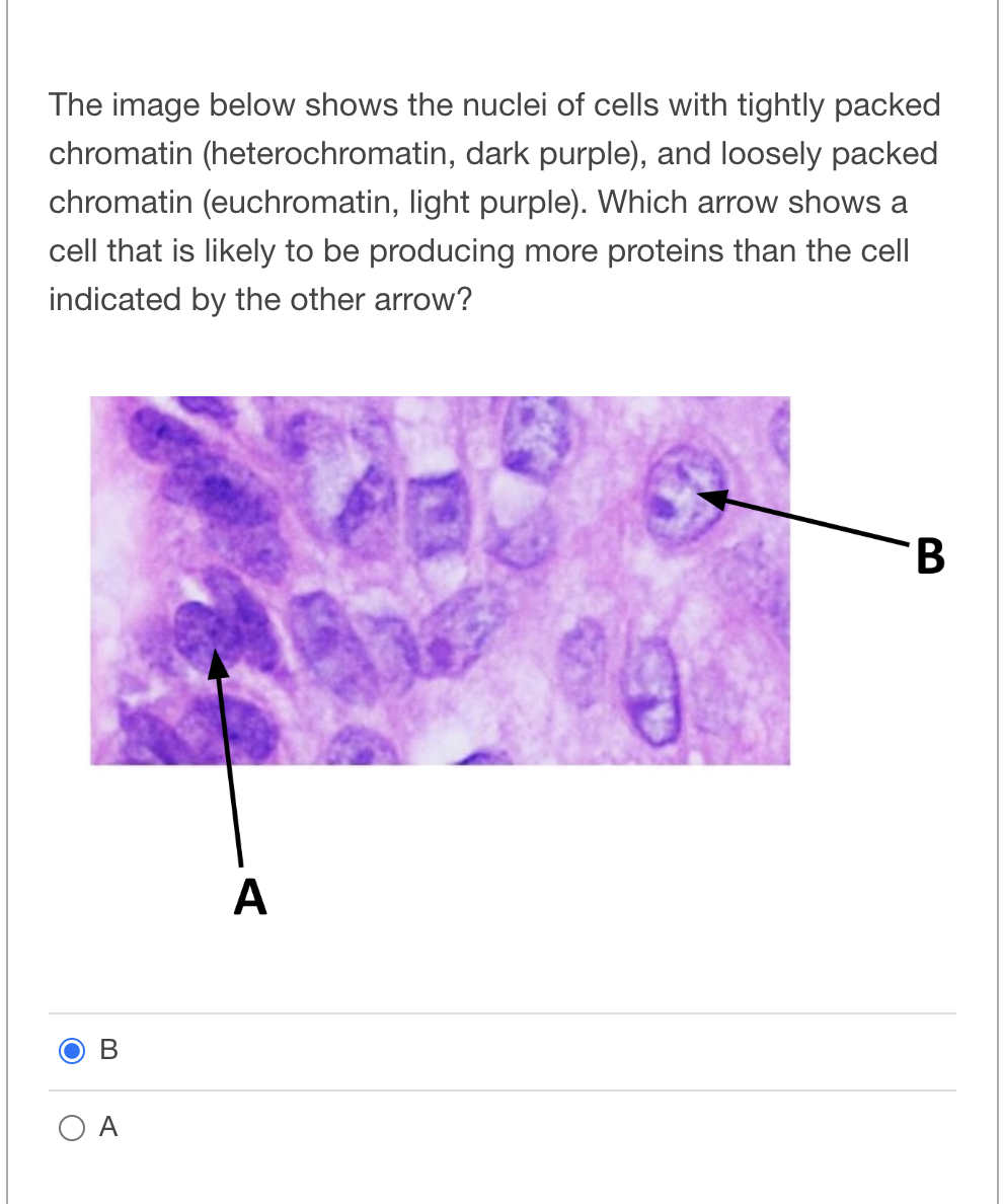 Solved The image below shows the nuclei of cells with | Chegg.com