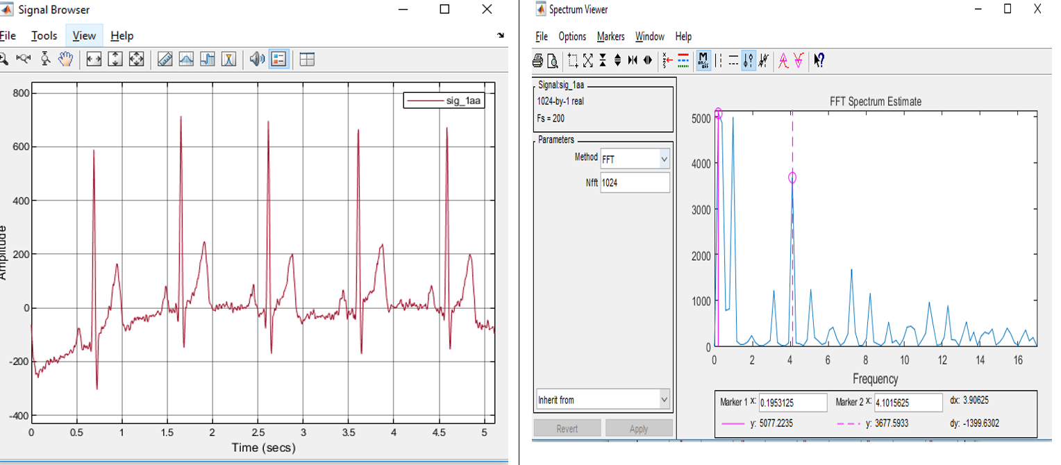 Solved iii. iv. Describe each signal in the time domain. | Chegg.com