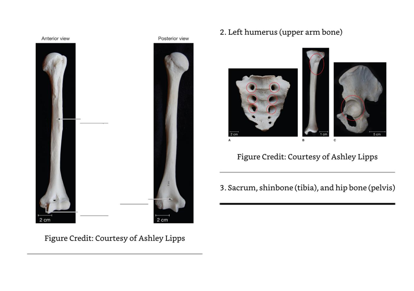 Solved Exercise 5 bone features this exercise is to help you | Chegg.com