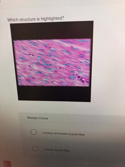 Solved Which structure is highlighted? Multiple Choice | Chegg.com