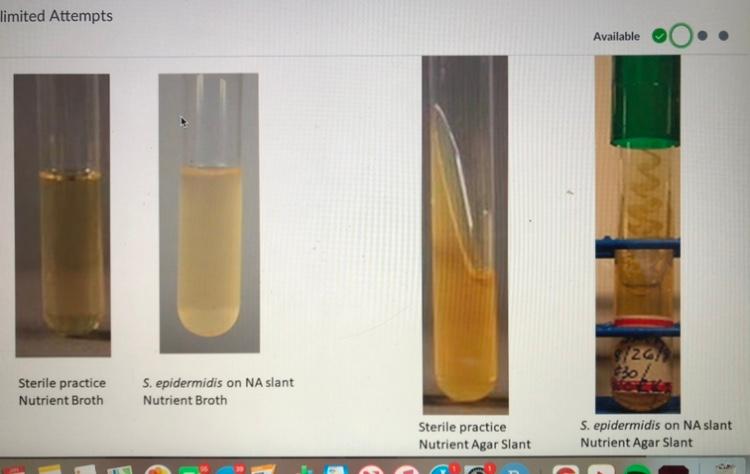 Solved S BROTCISO ( IS) 1-2 Common Aseptic Transfers and | Chegg.com