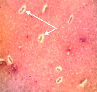 Solved 49) Observe the micrograph and draw conclusions about | Chegg.com