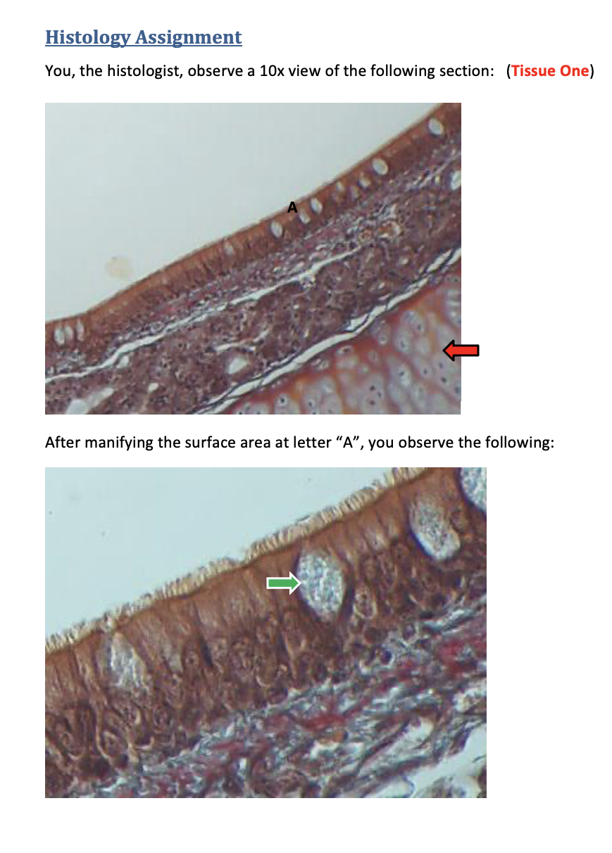 Solved Histology Assignment You, the histologist, observe a | Chegg.com