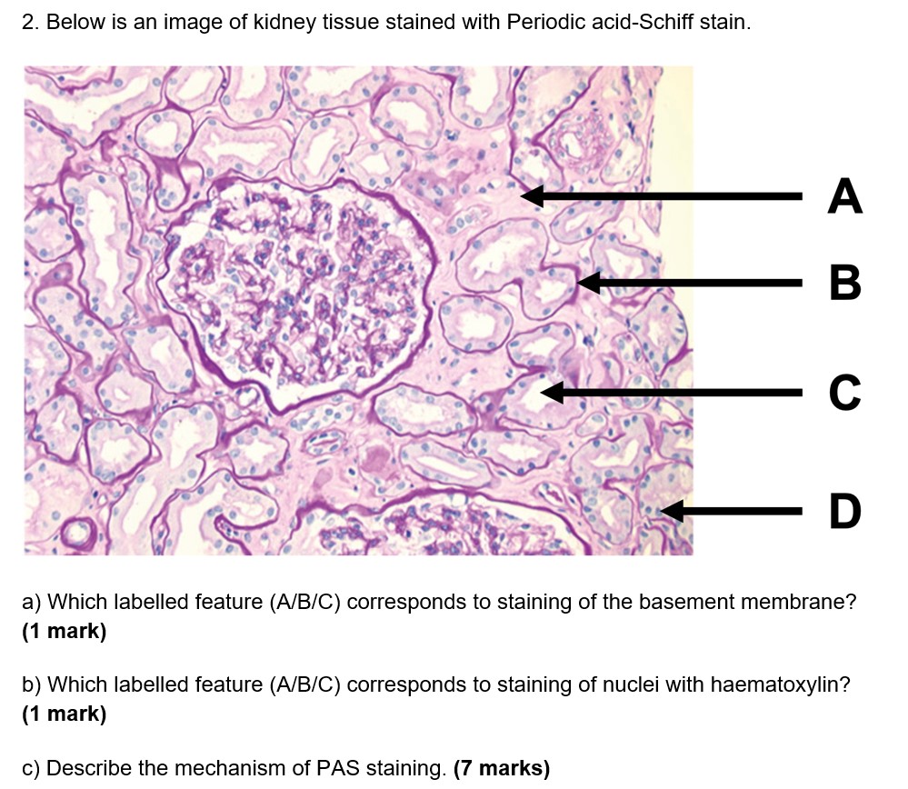 Solved 2. Below is an image of kidney tissue stained with | Chegg.com