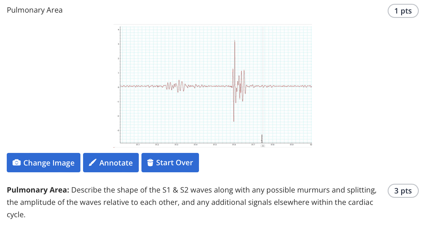 Solved Pulmonary AreaPulmonary Area: Describe the shape of | Chegg.com