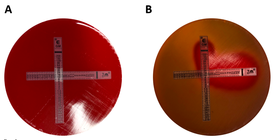 Solved 2.a. What is the MIC for penicillin G (PG) from plate | Chegg.com