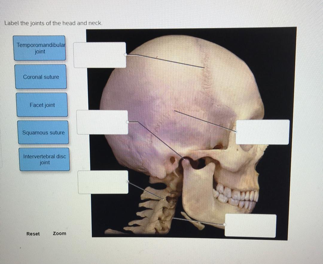 Solved Label the joints of the head and neck. | Chegg.com