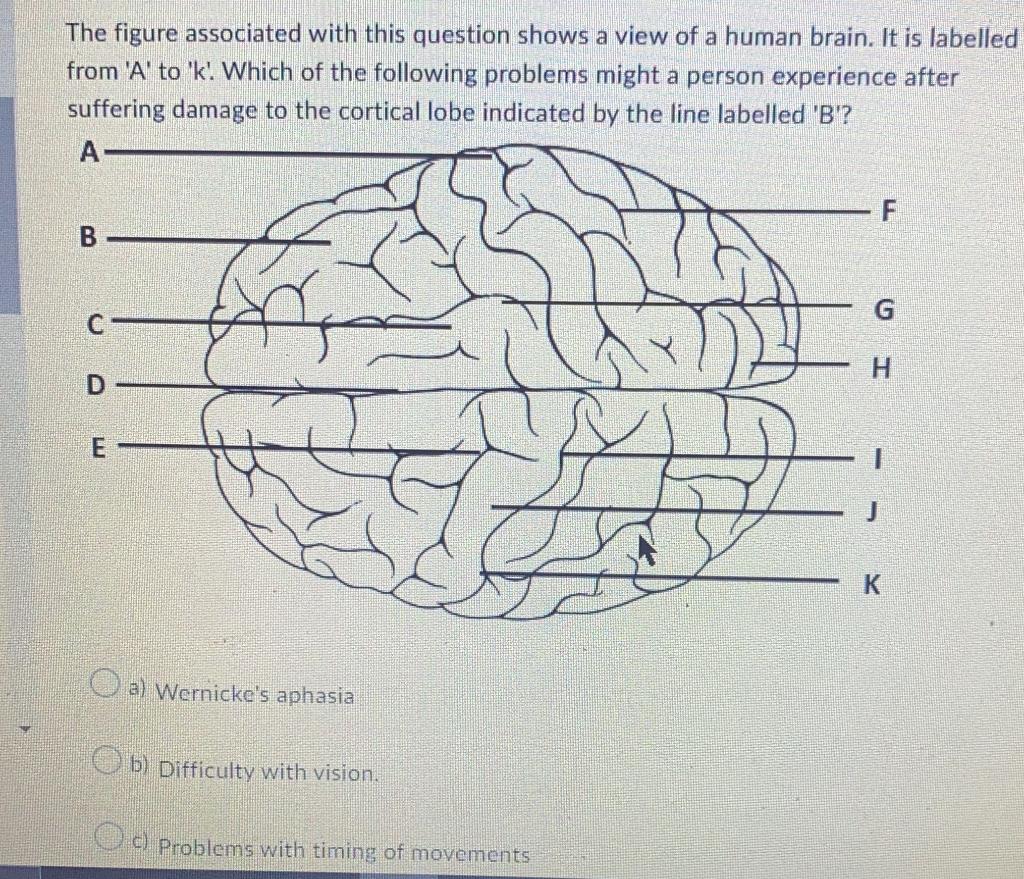 Solved The figure associated with this question shows a view | Chegg.com