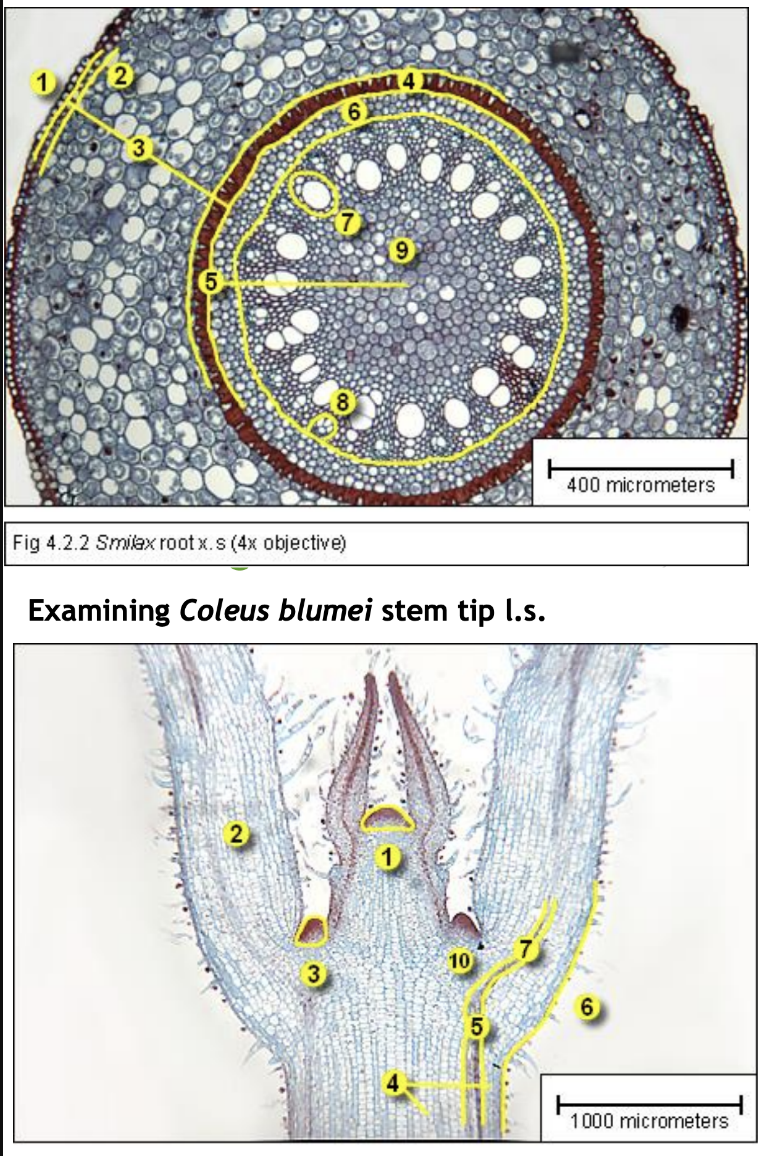 Solved 1 400 micrometers Fig 4.2.2 Smilax root x.s(4x | Chegg.com