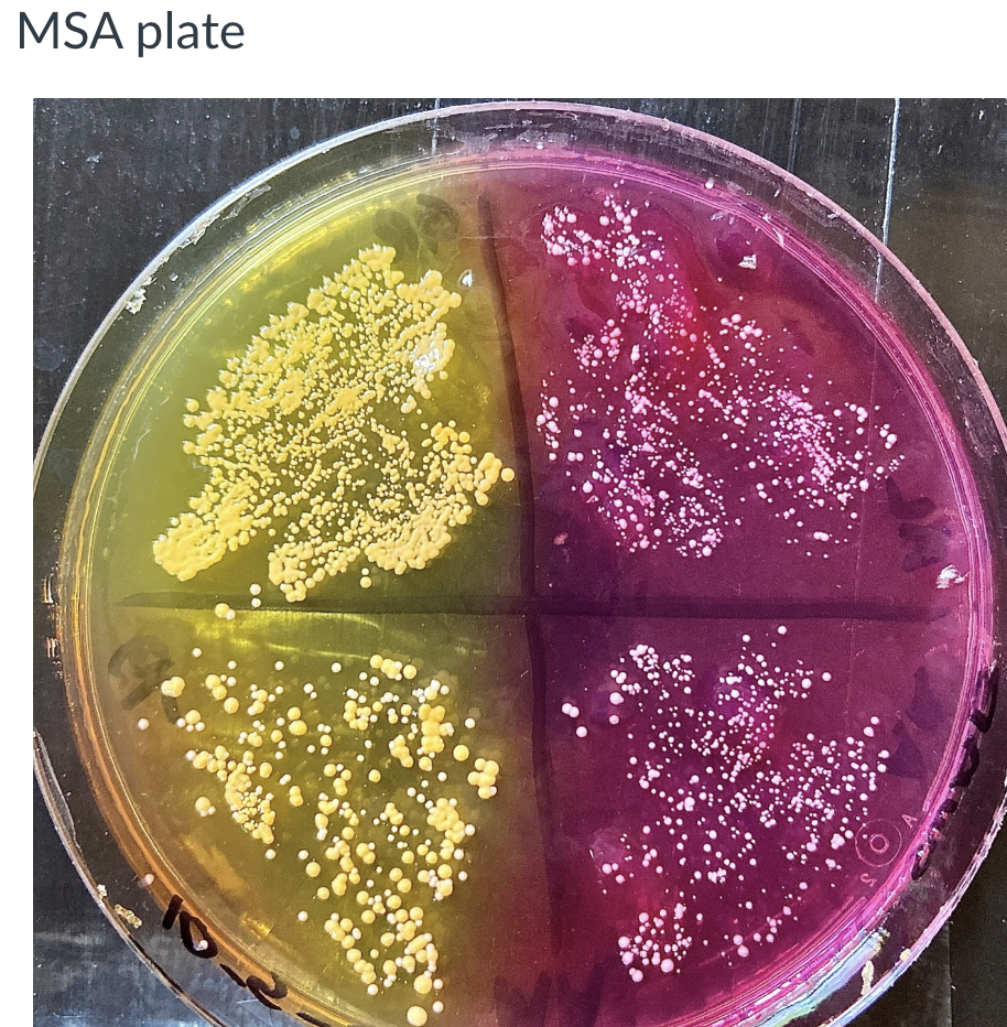 Solved How many different types of colonies can you detect | Chegg.com
