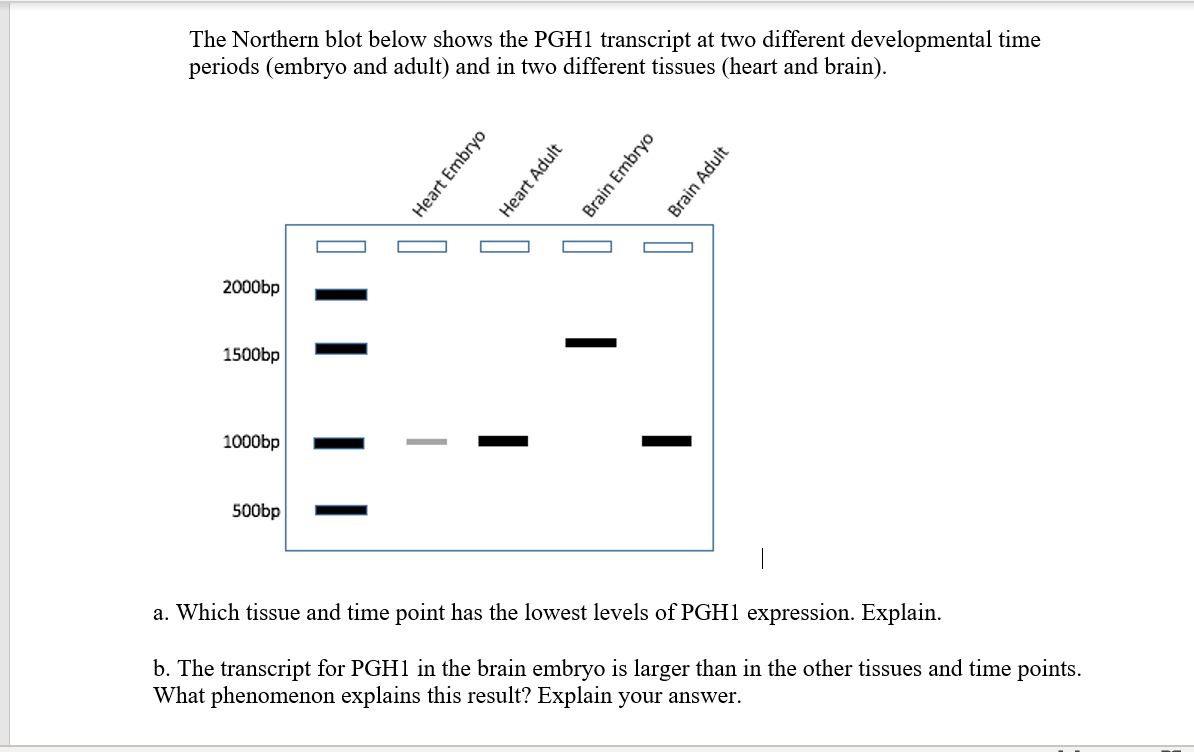 Solved The Northern blot below shows the PGH1 transcript at | Chegg.com