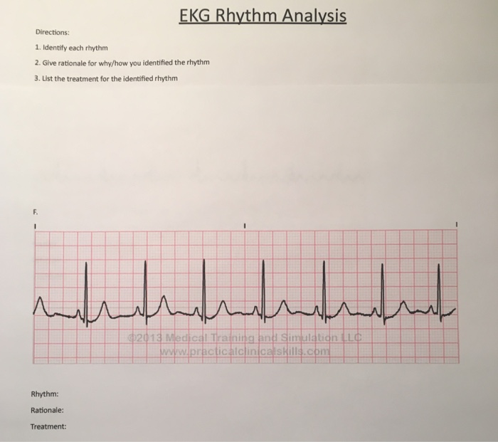 Solved EKG Rhythm Analysis 1. Identify each rhythm 2. Give | Chegg.com