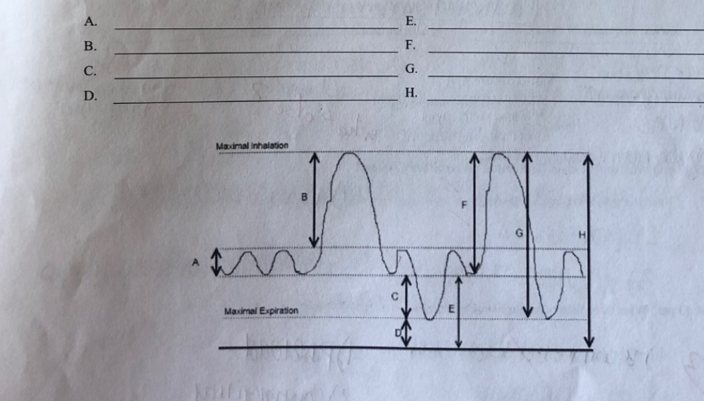 Solved Label The Following Spirogram With The Appropriate 