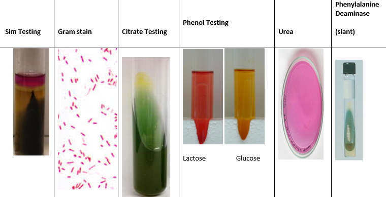 Proteus Mirabilis Gram Stain