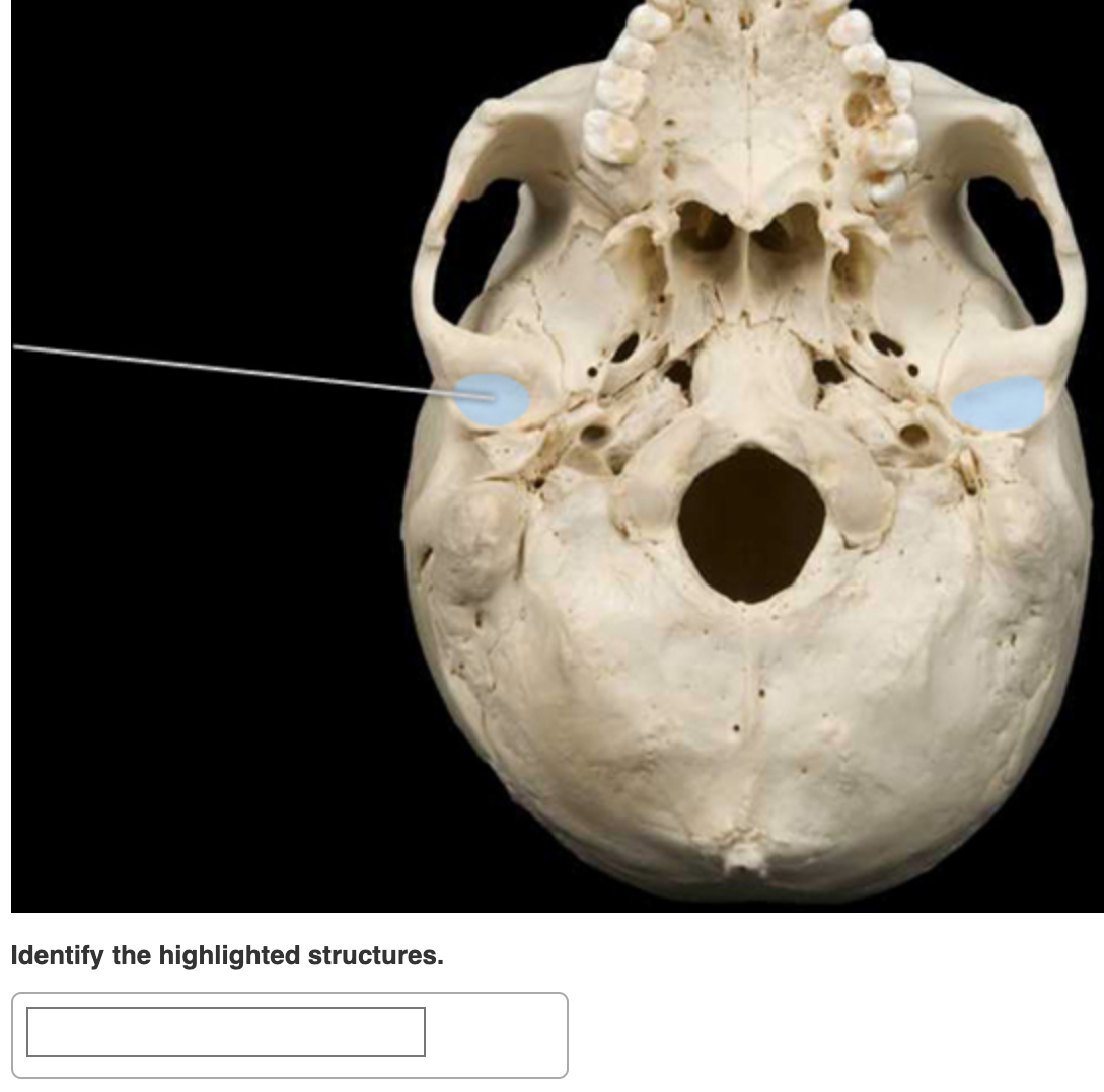 Solved Identify the highlighted structures. | Chegg.com