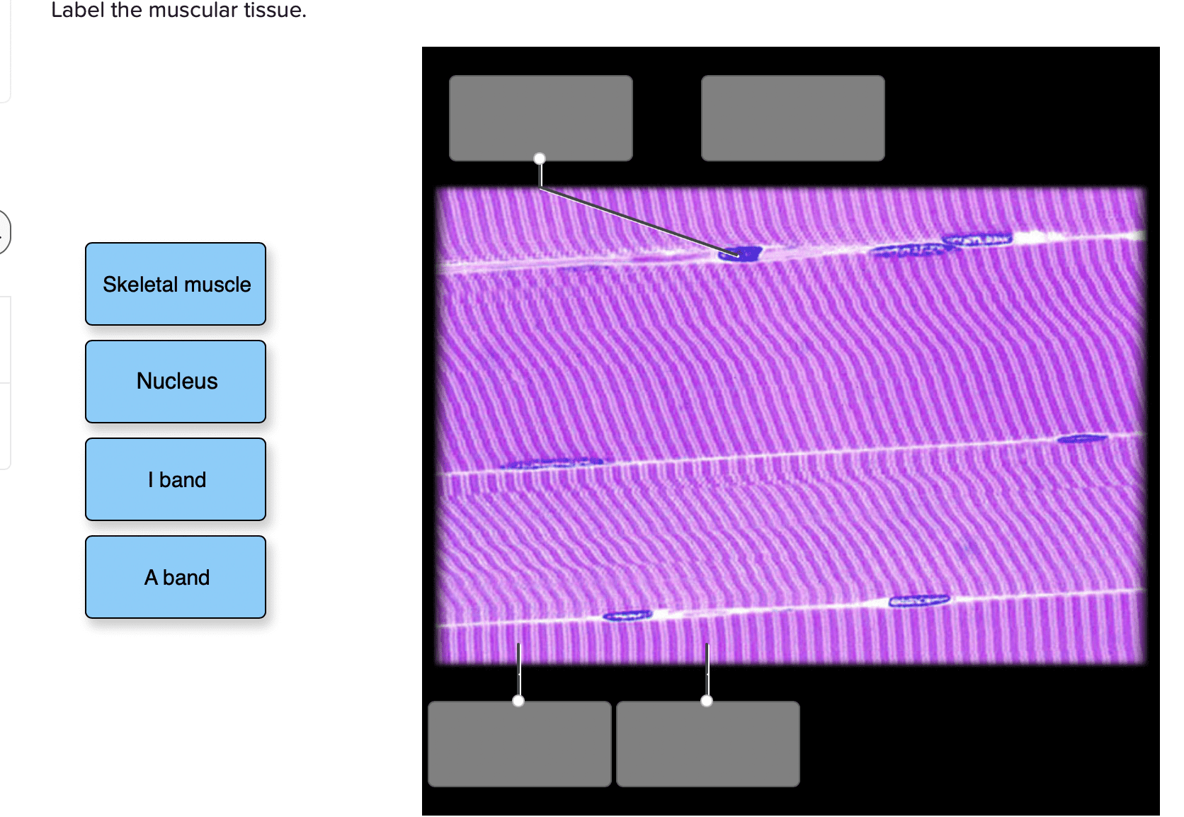 Solved Label the muscular tissue. | Chegg.com