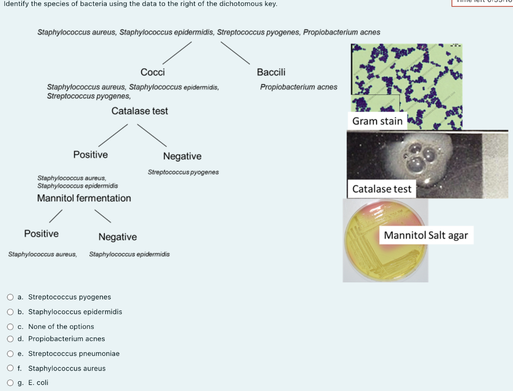 Streptococcus Pyogenes Gram Stain